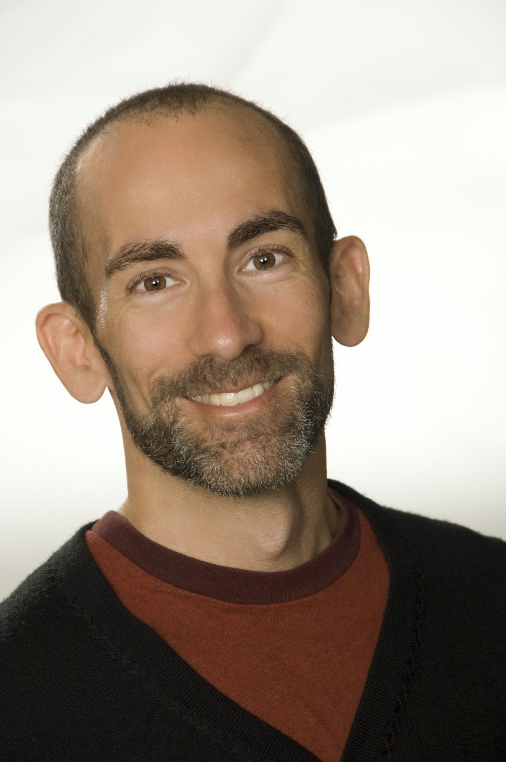 The Power of Purple Webinar Series - Epilepsy Surgery and Other ...